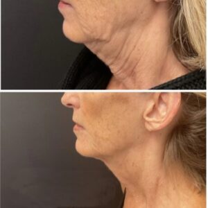 Our Results - Snatched Aesthetics