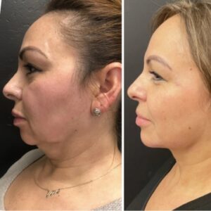 Our Results - Snatched Aesthetics