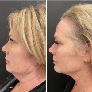 Our Results - Snatched Aesthetics