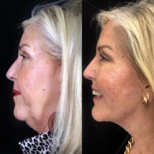 Our Results - Snatched Aesthetics