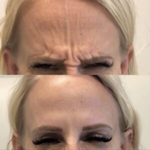 Our Results - Snatched Aesthetics