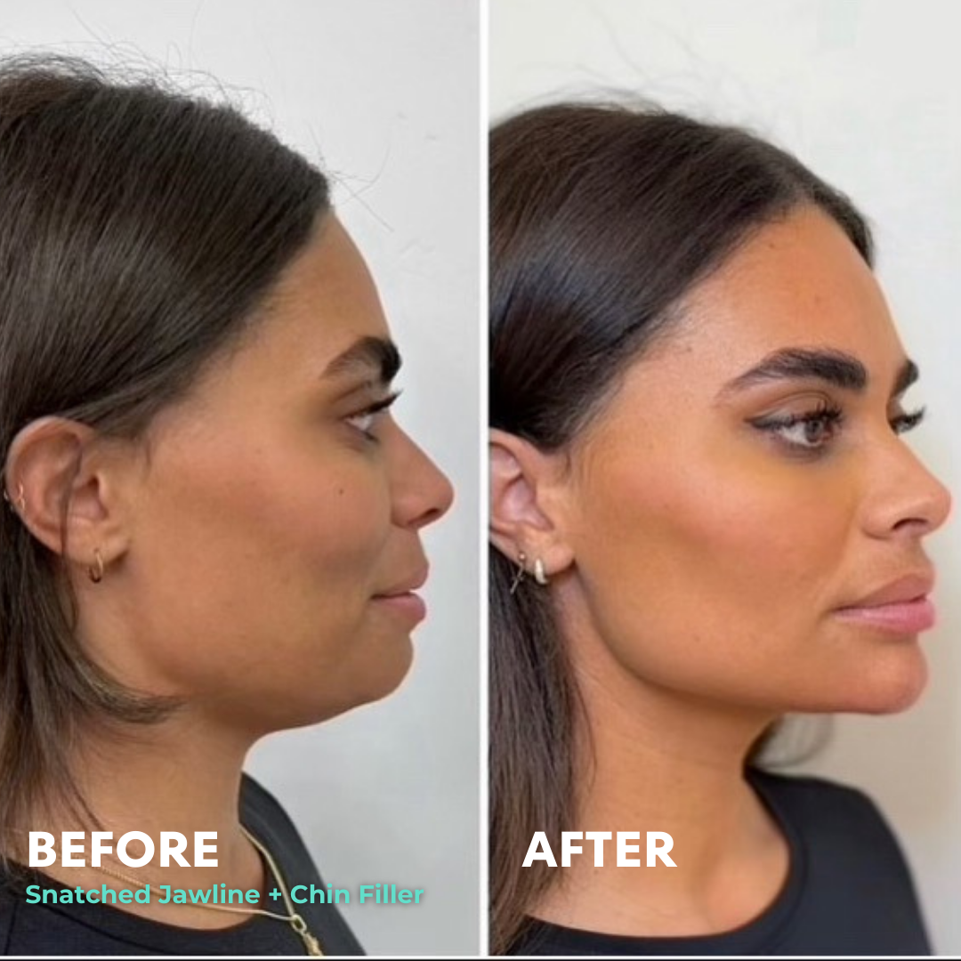 Our Results - Snatched Aesthetics